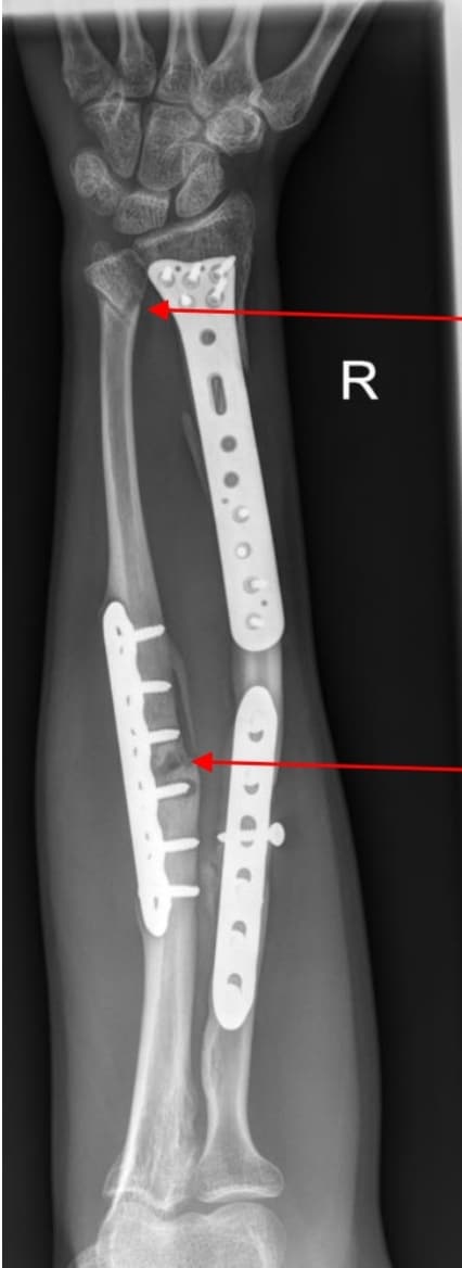 Patient, turned colleague, reunited with ambulance team - NHS South ...